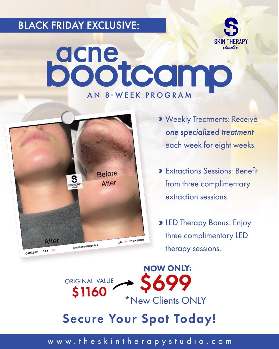 Acne Bootcamp - The Skin Therapy Studio